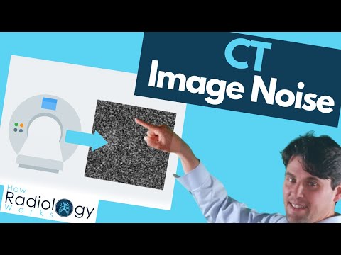 CT Image Noise (Dependence on Technical parameters)