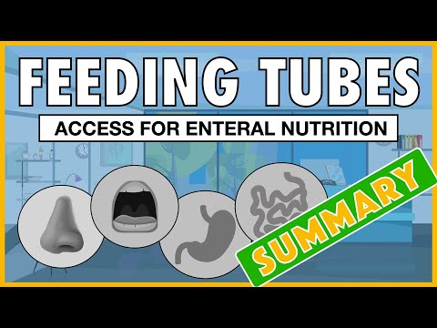Feeding Tubes (SUMMARY)