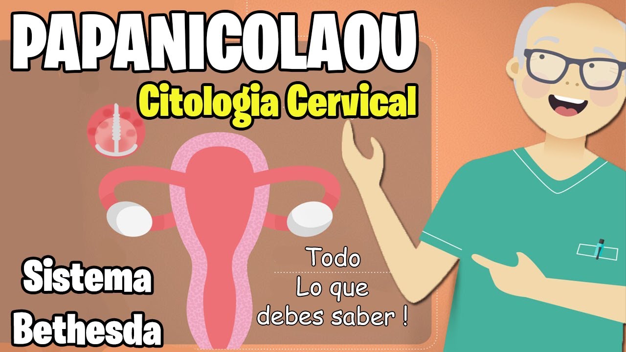 PAPANICOLAOU Citologia cervical | CUANDO SE HACE , COMO SE HACE, RESULTADOS Y MANEJO