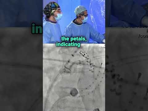 Julian Chun demonstrates the use of the FARAPULSE system for PFA with LAA Closure.