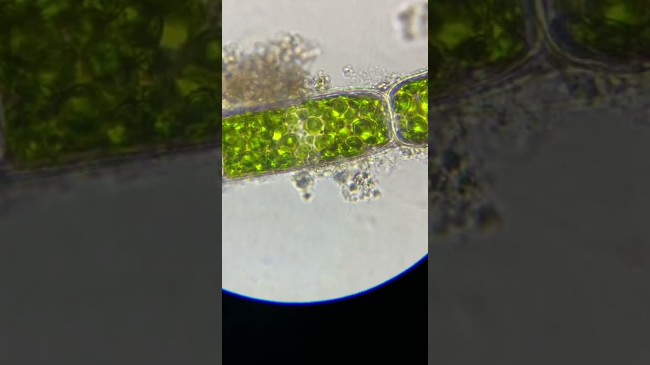 Algae under a microscope