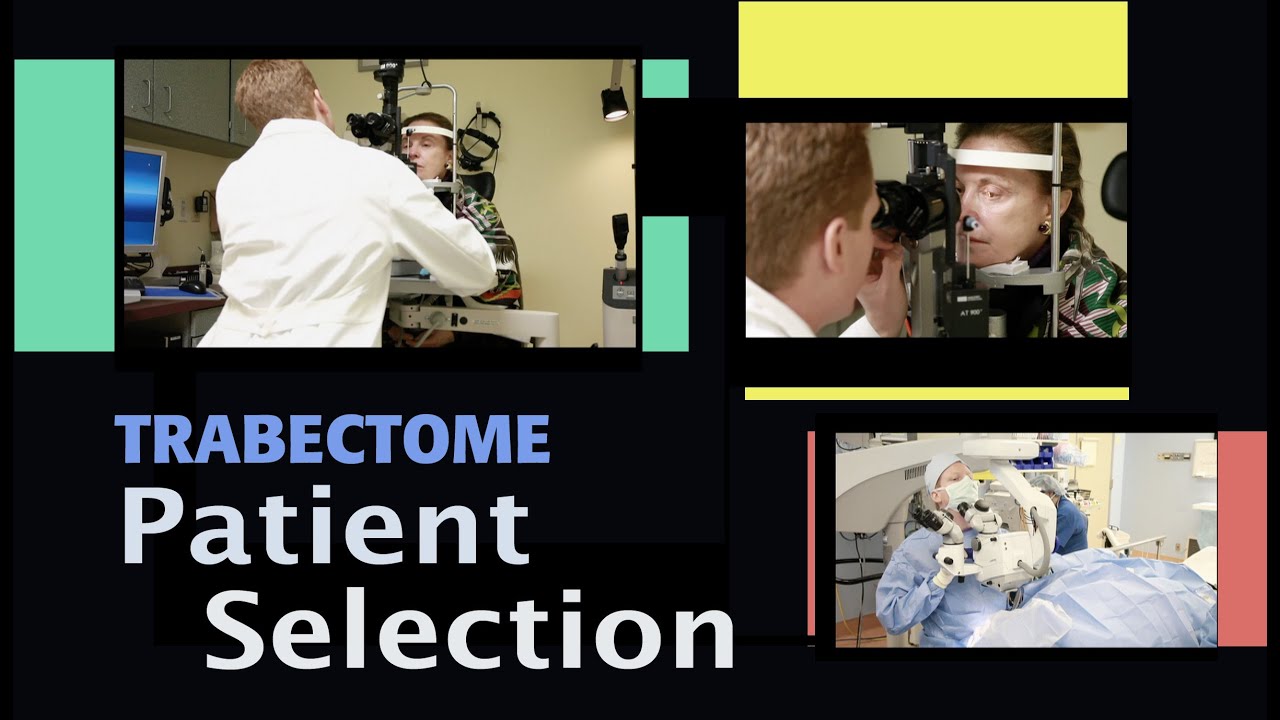 Patient Selection for Trabectome Surgery