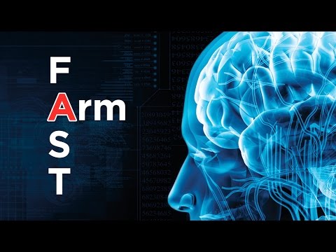 FAST Stroke Awareness - Arm