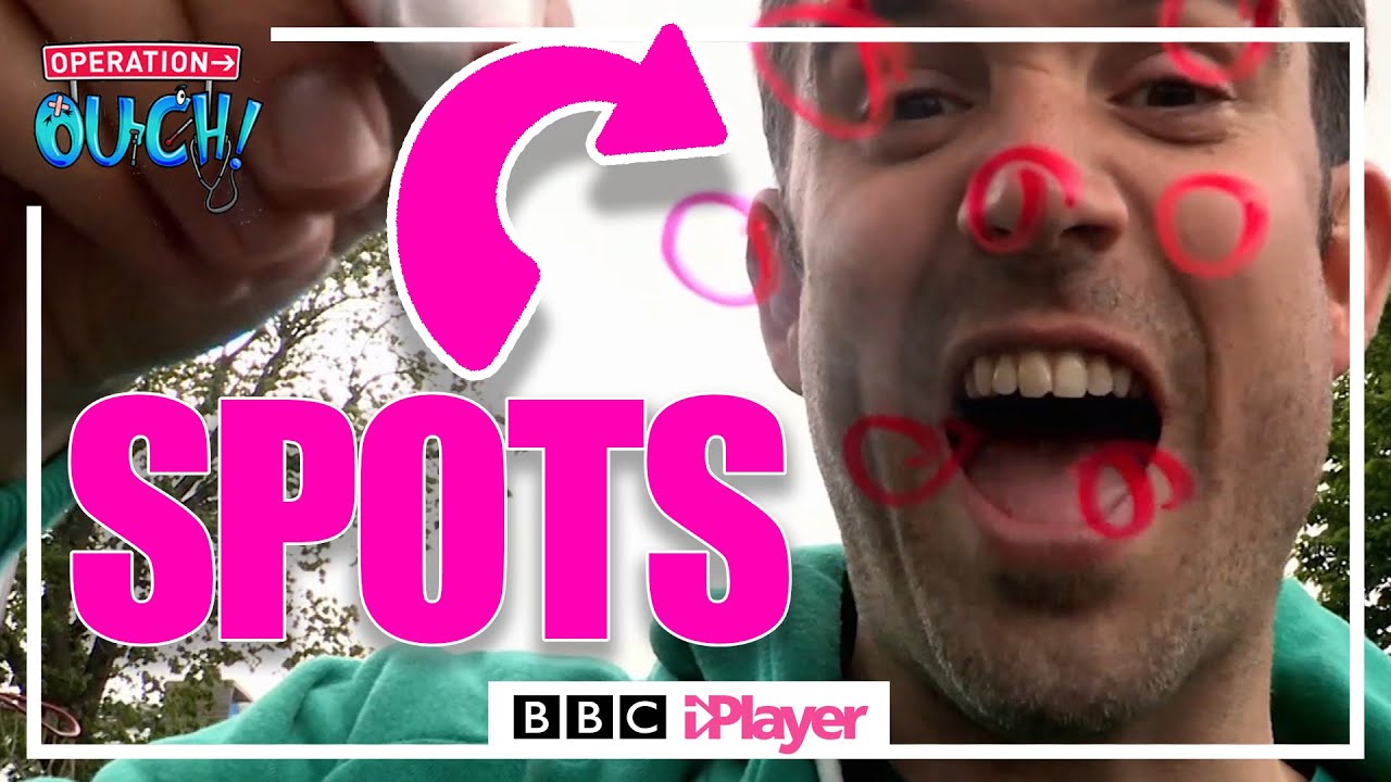 Puberty FACTS | Operation Ouch