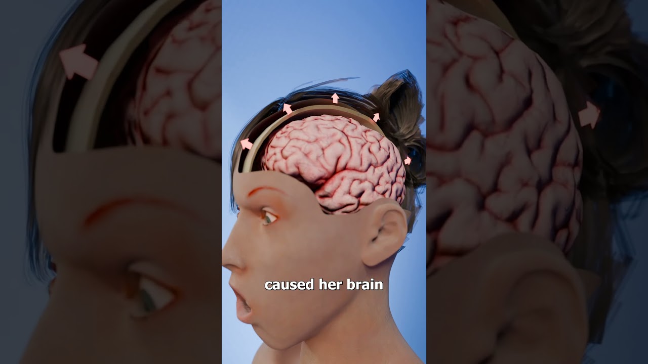 Water Drinking Contest Gone Wrong 😨