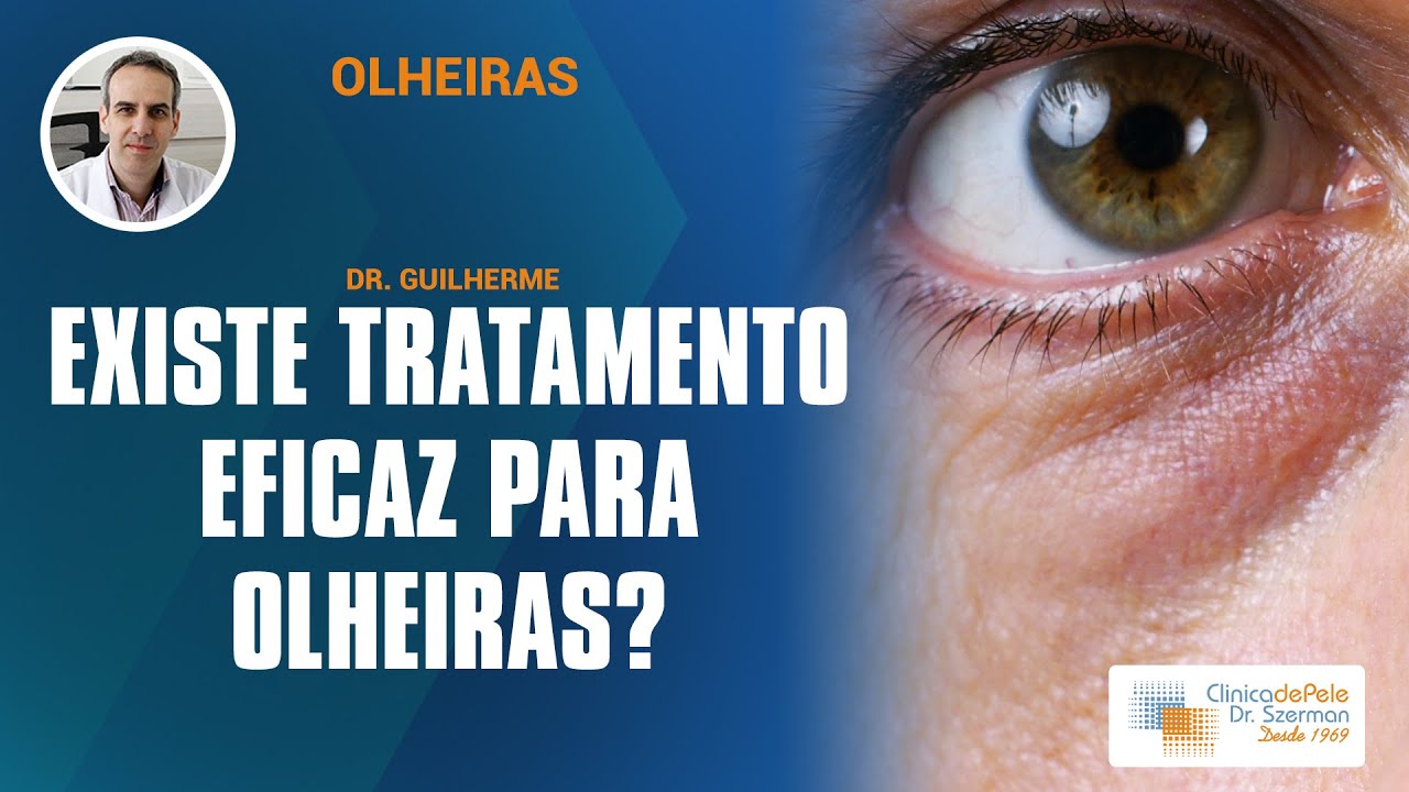 Olheiras [Existe Tratamento Eficaz?]