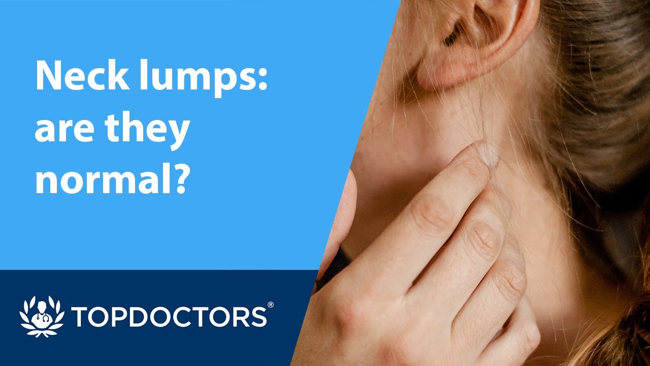 Neck lumps: are they normal?
