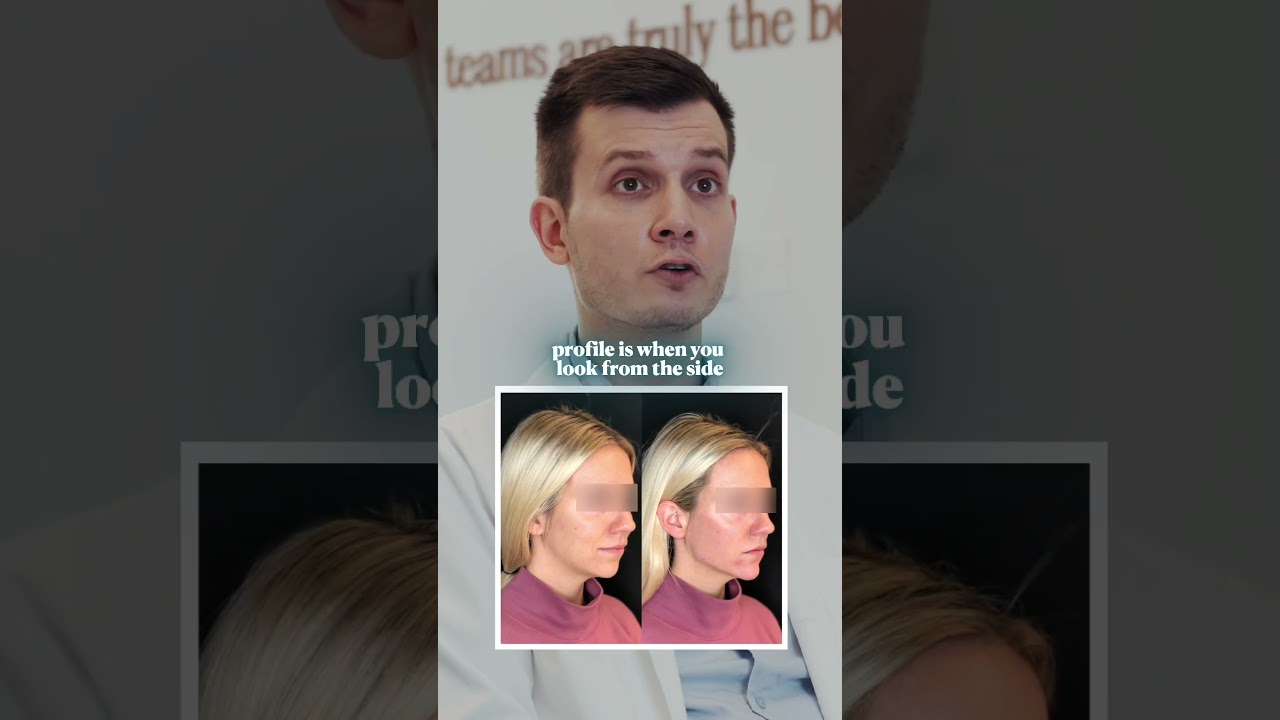 Can braces change my face shape? 🤔🦷