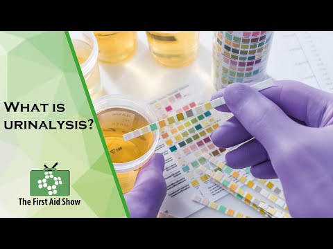 What is urinalysis?