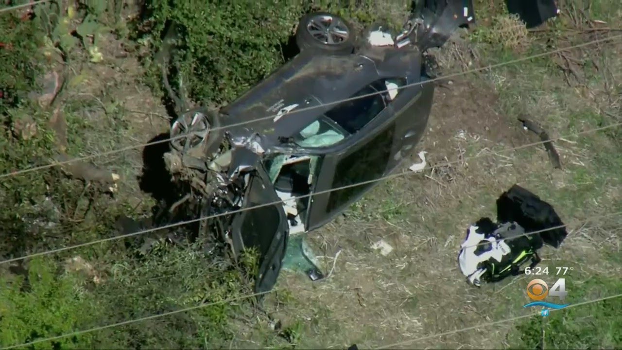 Tiger Woods Suffers Injuries To Both Legs Following Single-Car Crash