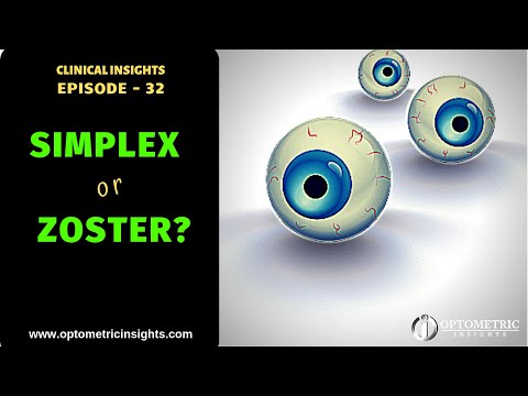 Is it Simplex or Zoster? - Episode 32