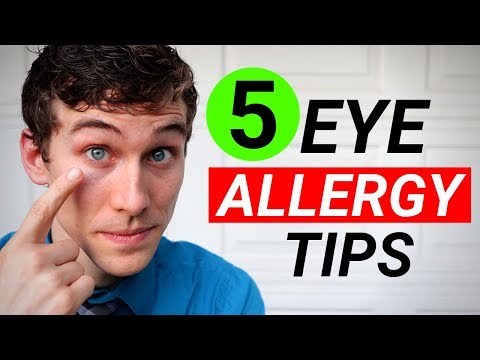 How to Get Rid of Itchy Eyes - 5 Tips for Itchy Eyes Allergy Relief
