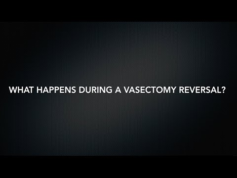 Dr. Aaron Spitz - What Happens During a Vasectomy Reversal?