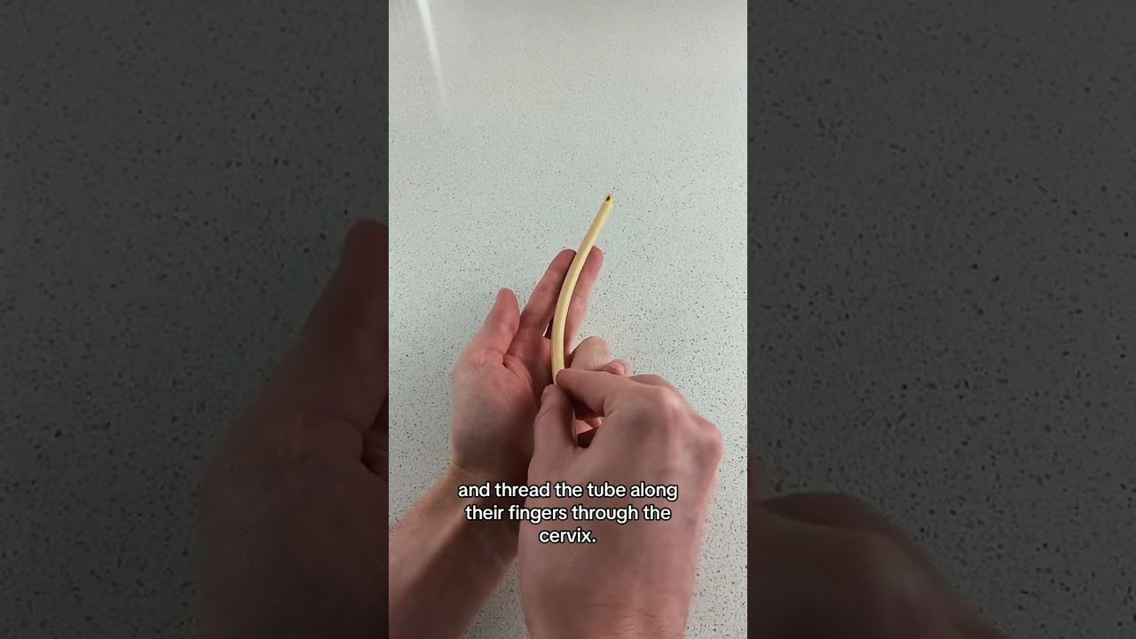 Pregnancy Induction Of Labor Methods (Cervical Ripening Balloon) - Foley Balloon Induction