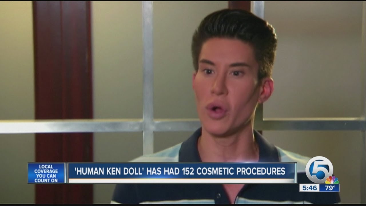 'Human Ken Doll' has had 152 cosmetic procedures