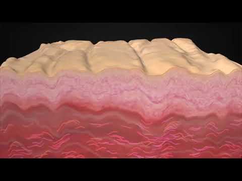 Cynosure Picosure Laser work - www.aestheticsmedicallaser.com