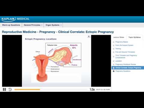 USMLE® Step 1 Reproductive Medicine: Ectopic Pregnancy