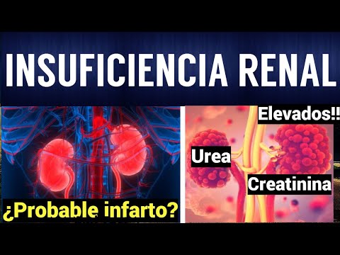 INSUFICIENCIA RENAL AGUDA Y CRÓNICA | Fisiopatología, Síntomas y Tratamiento |