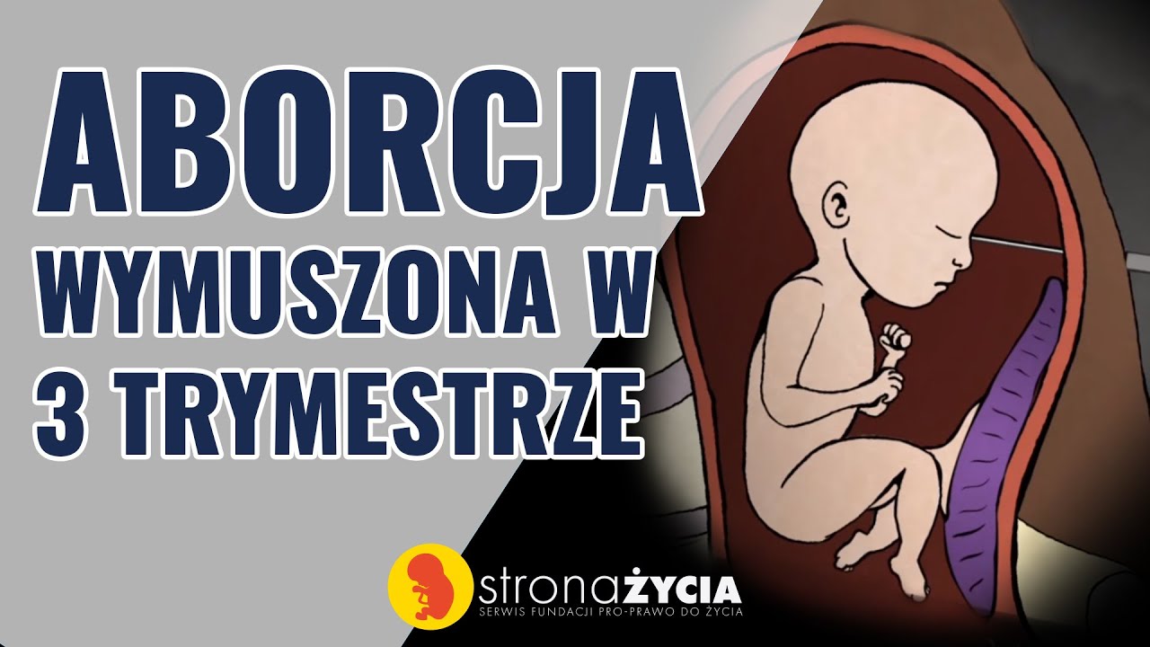 Nawrócony aborcjonista wyjaśnia jak wygląda aborcja - Strona Życia