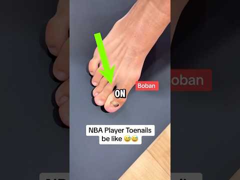 Why do nba players have the nastiest feet #nba #basketball