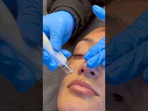 Your skin, but better ✨ The Diamond Glow facial deeply exfoliates for the ultimate glow! #medspa