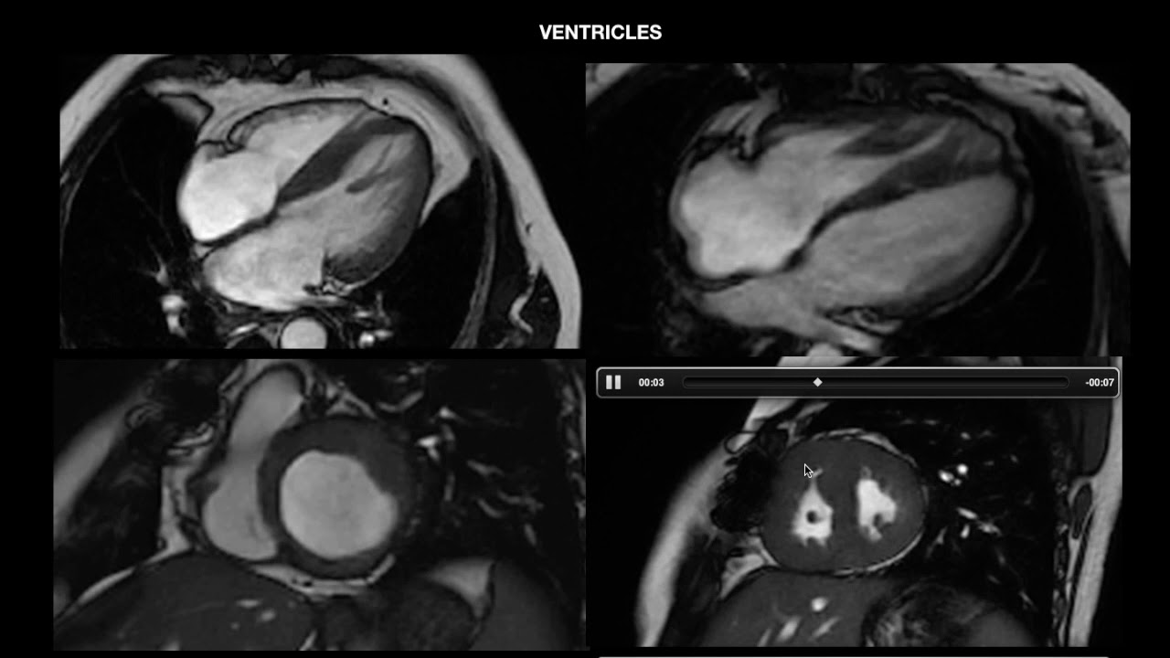 4. CMR Anatomy and Imaging Planes