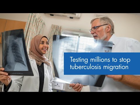 Testing millions to stop tuberculosis migration