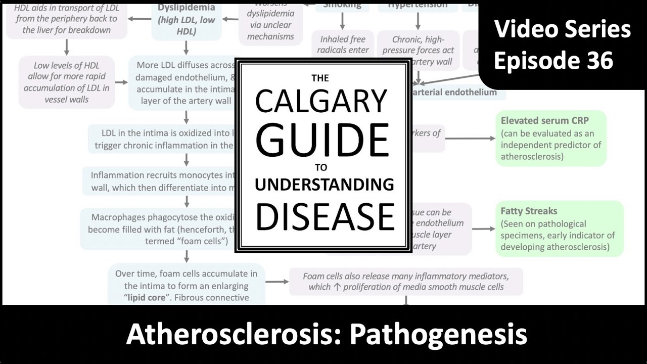 Atherosclerosis: Pathogenesis