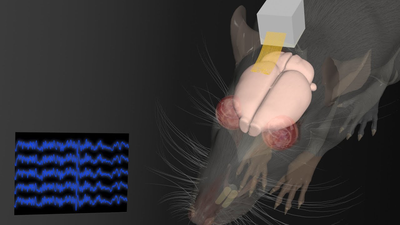 Soft elastic brain-machine interfaces