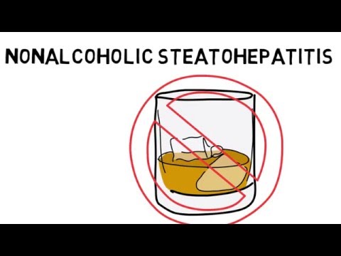 What is NASH and what causes it