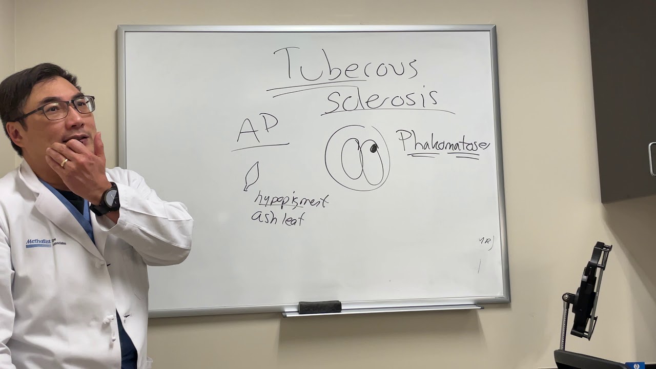 Tuberous sclerosis