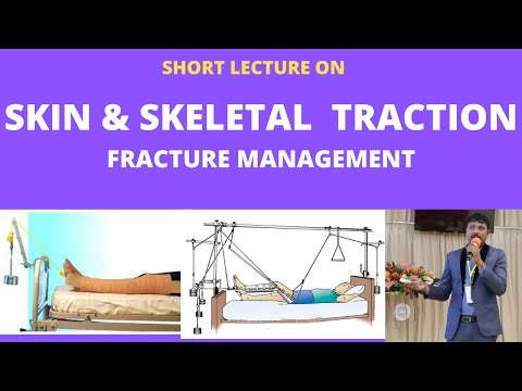 SKIN & SKELETAL TRACTION IN FRACTURE MANAGEMENT