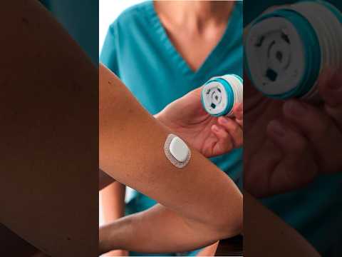 Medtronic’s New Simplera CGMs Explained