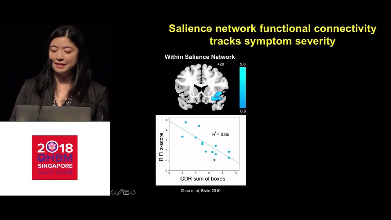 OHBM 2018 | Symposium | Juan Zhou | Functional Connectivity in Aging and Dementia: From Nodes to N…