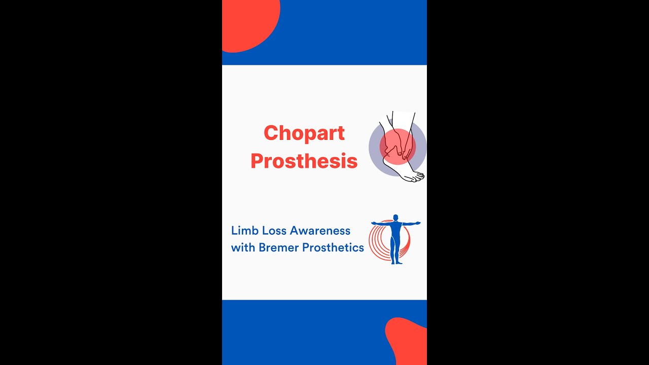 Diagnostic socket chopart amputee