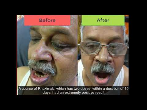 Dr Vijay Rao, Rheumatologist Banglore