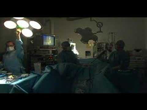 Prostate Cancer: Why Surgery is Difficult (Dramatic Health)