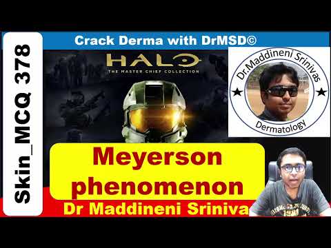 DrMSD Explains The DIFFERENCE Between Halo Dermatitis And Meyerson Phenomenon