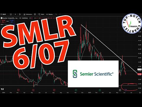 Semler Scientific (SMLR) Stock: Price Predictions Using Technical Analysis.