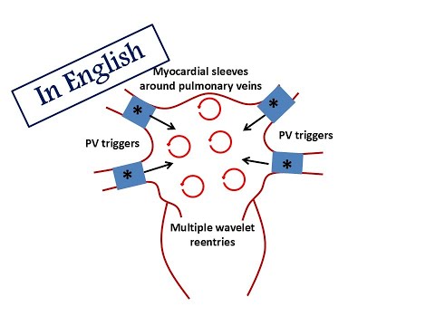 ESC Guidelines of AF: 1. Definitions & Clinical Impact of AF (English Version)