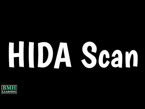 HIDA Scan Test | Cholescintigraphy | IDA Scan For Gallbladder | Hepatobiliary Scintigraphy |