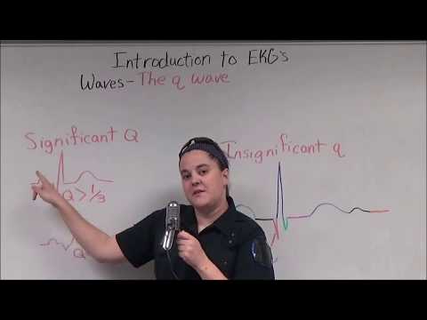 Introduction to EKG's--Waves and Segments