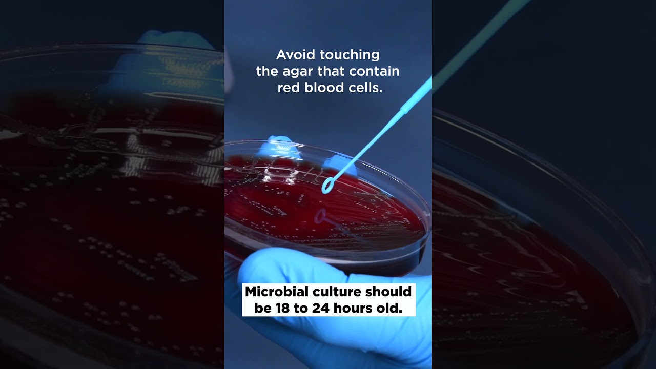 How to perform the Catalase test #staphylococcus #microbiology #streptococcus