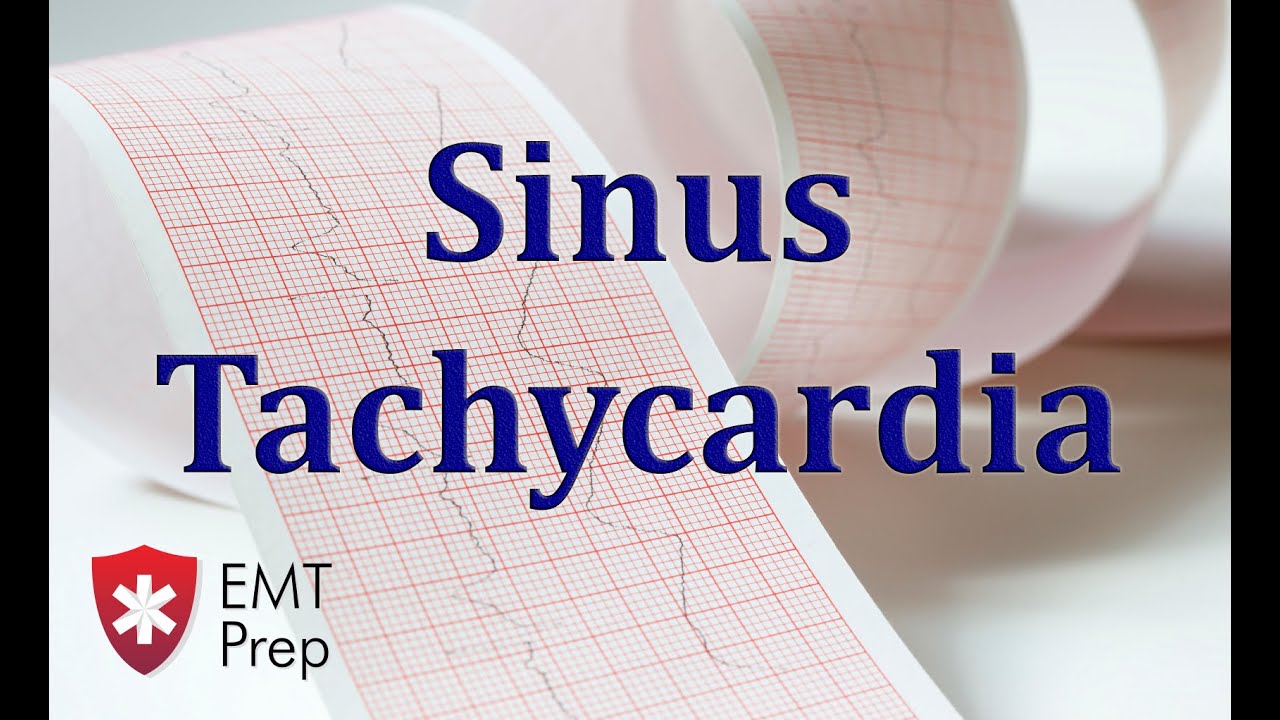 Sinus Tachycardia ECG - EMTprep.com