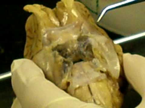 Anatomy of Sheep Brain
