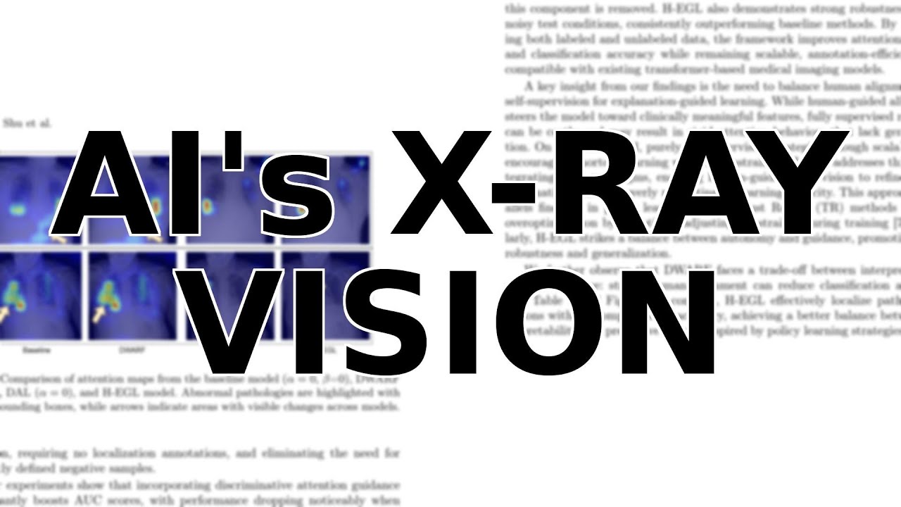 This New AI Teaches Itself to Read X-Rays Like a Top Radiologist