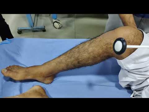 Hyperreflexia: Ankle and Knee Reflex