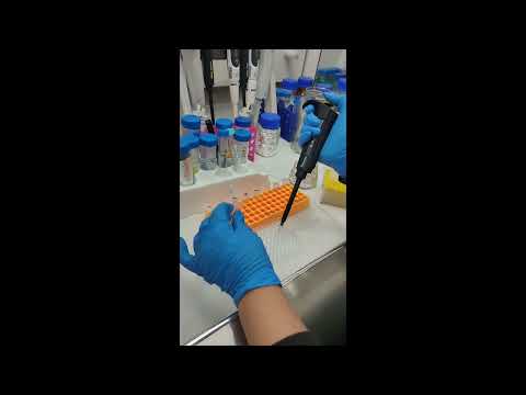 ABTS Antioxidant analysis