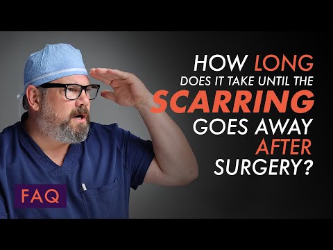 Treating Scars After Surgery