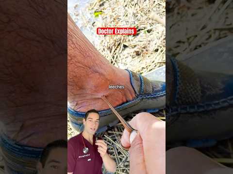Doctor Reacts: leeches as medicine?!